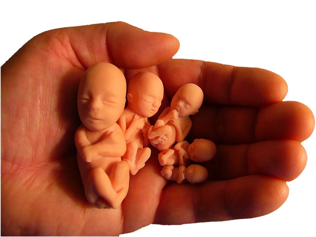 Abortion Pictures Mouade Agafay abortion-pictures-mouade-agafay